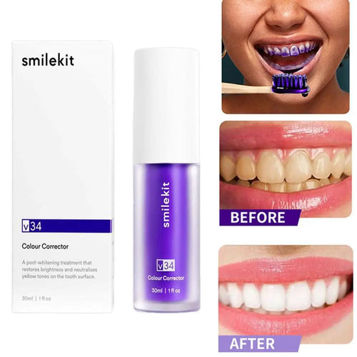 משחה להלבנת השיניים - smilekit – lbjewellry